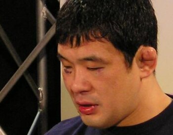 15 Worst Mangled Ears Caught on Camera in Sports History | Bleacher Report